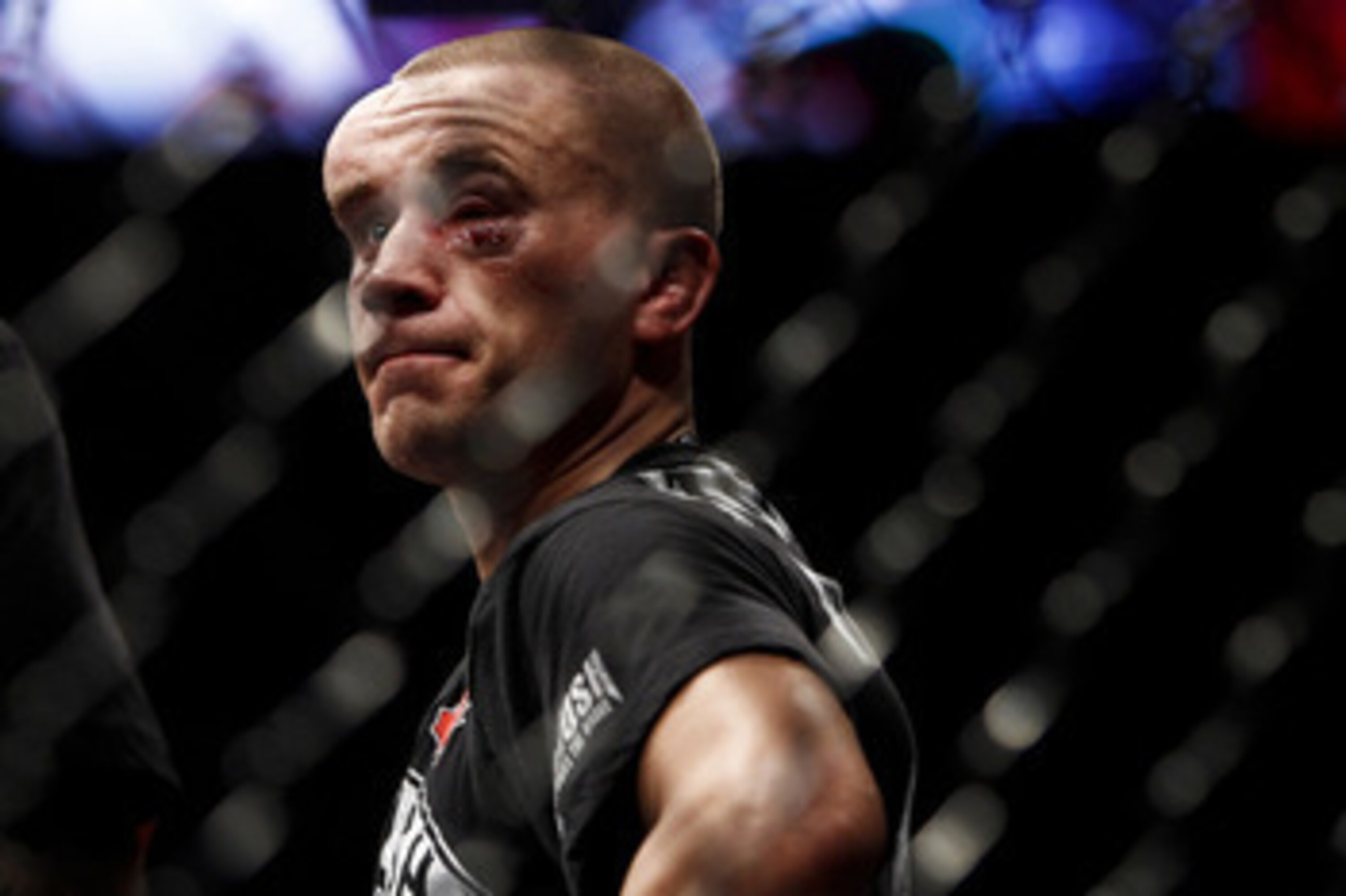 UFC 129 Results: 5 Mark Hominick Head and Eye Photos After Fight with ...