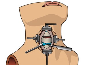 Peyton Manning's Neck, 2014 Return: What Will Doctors Look for This ...