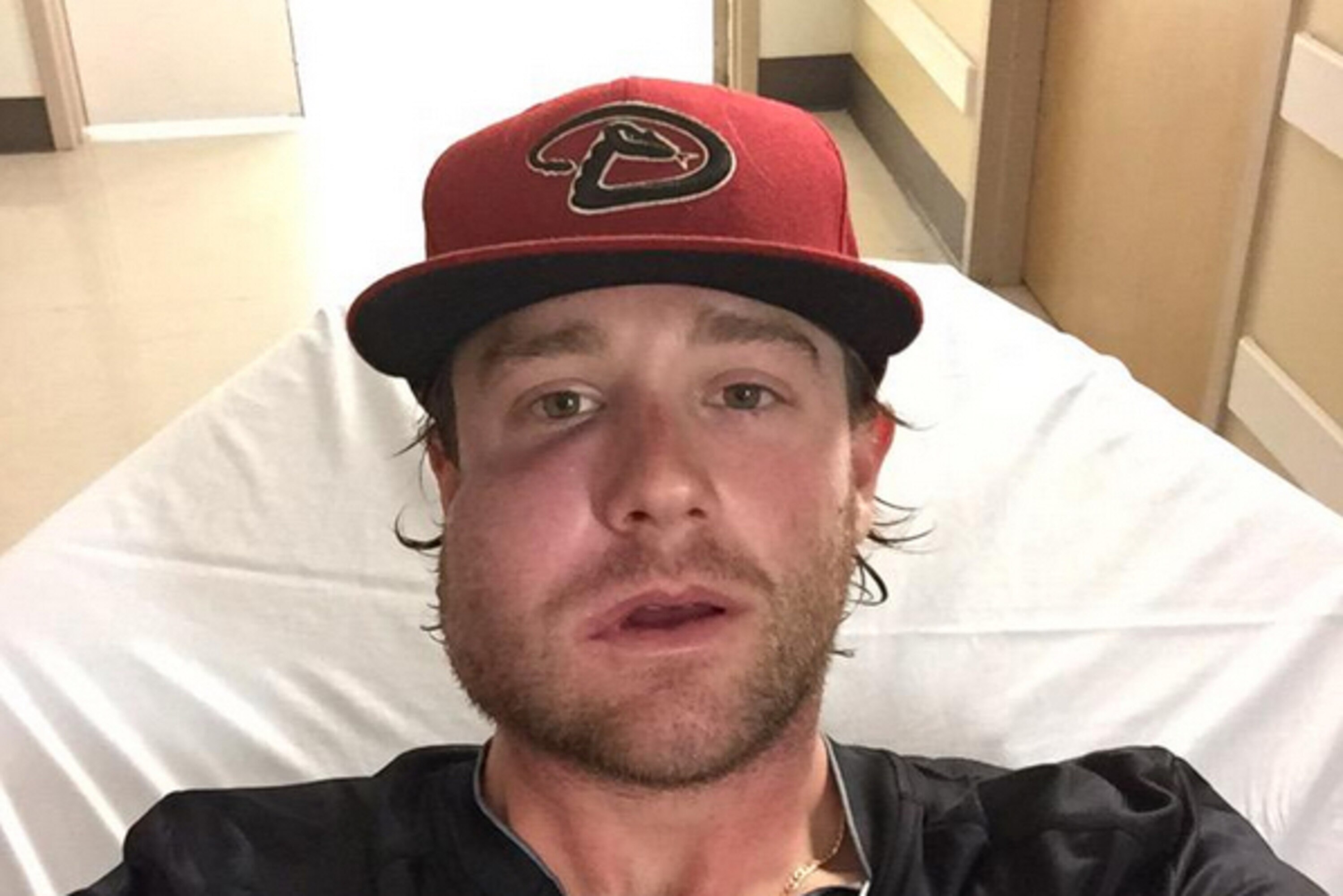 Archie Bradley Injury: Updates on Diamondbacks Pitcher After Line Drive ...