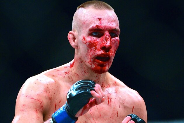 Rory MacDonald Injury: Updates on UFC Star's Nose, Foot
